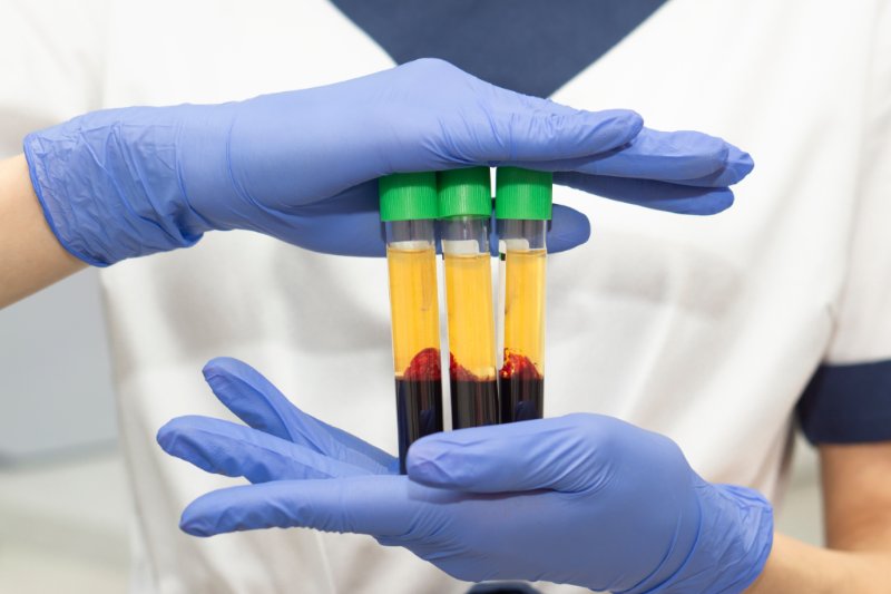 הכנה לזריקת PRP: הנחיות חשובות להצלחת הטיפול | Prolo Cure
